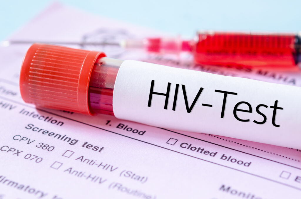 Nevis Reports Decrease in Annual HIV Incidence, Strengthens Prevention ...